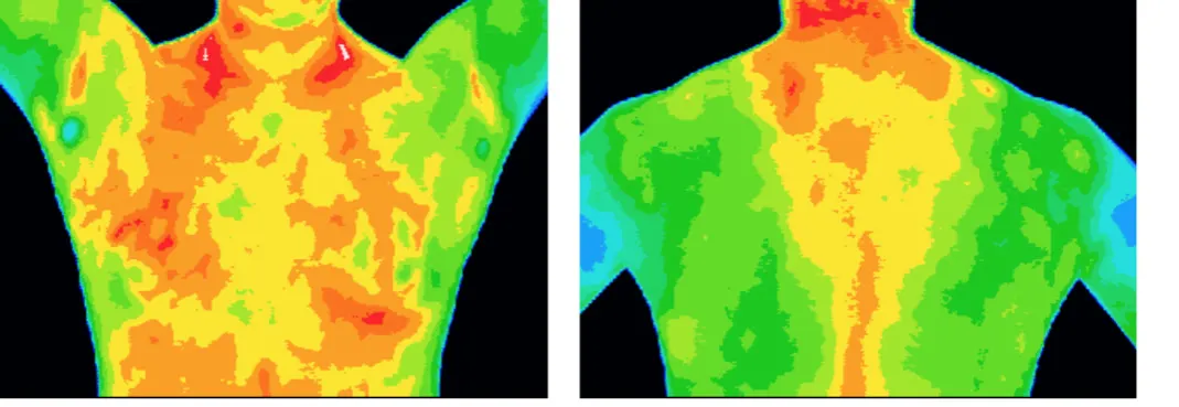 128: my experience with breast thermography - The Fitnessista